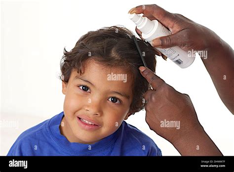 Female Lice Hi Res Stock Photography And Images Alamy