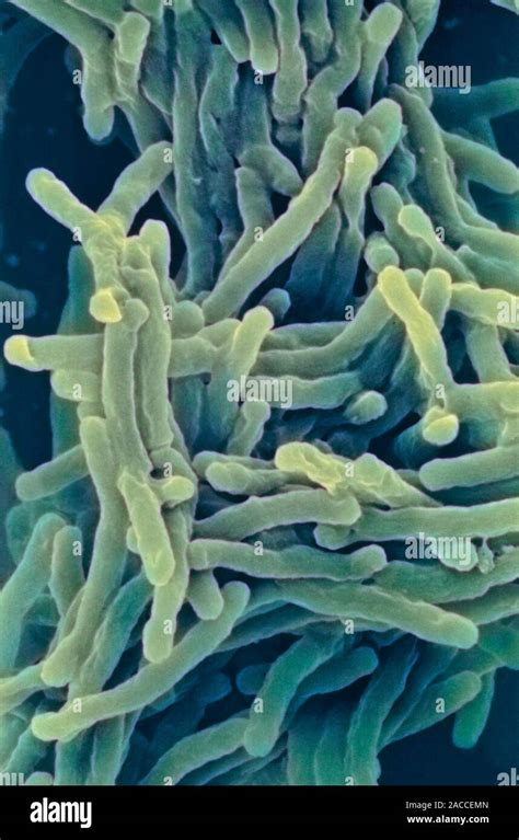 Tuberculosis Bacteria Coloured Scanning Electron Micrograph Sem Of Mycobacterium Tuberculosis