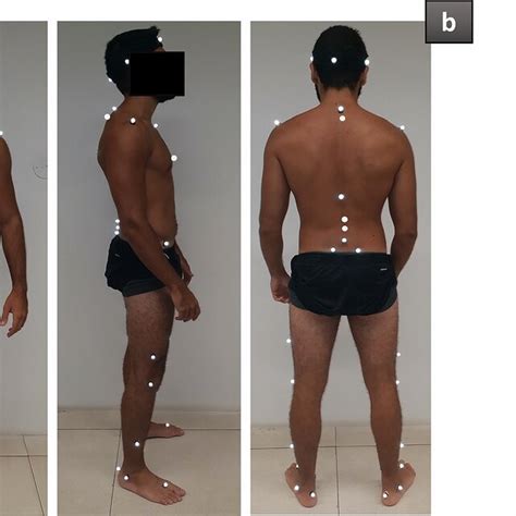 A Positioning Of Markers Used During Gait Acquisition B Download