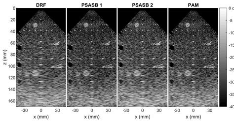 Figure 7 From Two Stage Beamforming For Phased Array
