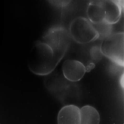 Banana Protoplast Culture On Feeder Layer System Download Scientific
