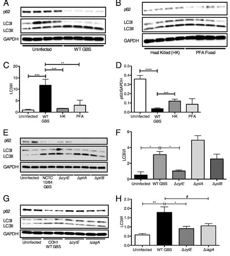 Figure 1 From The Role Of Autophagy During Group B Streptococcus
