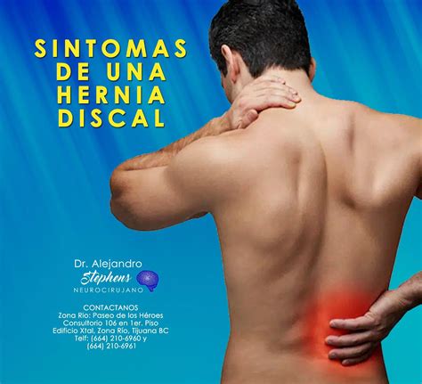 Dr Sintomas De Una Hernia Discal Algunas Hernias De Disco No Causan
