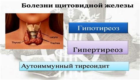 Аутоиммунный Тиреоидит Гипотиреоз Диета — Похудение Диета Правильное ...