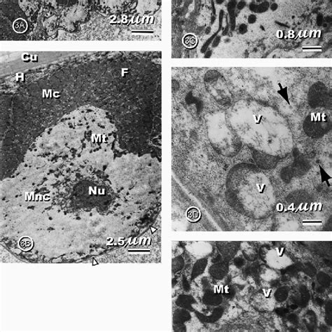 Transverse Section Of A Transmission Electron Micrograph Showing The Download Scientific