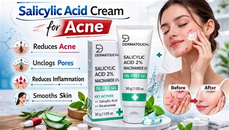 Complete Guide Salicylic Acid Cream For Acne Benefits And Uses