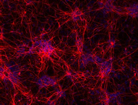 3d Bioprinting Of Ipsc Neuron Astrocyte Coculture