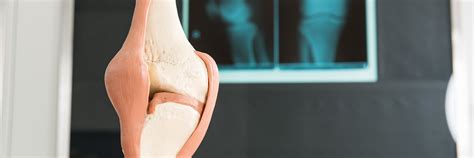 Restrictions After Meniscus Surgery Berkshire Orthopedics Llc