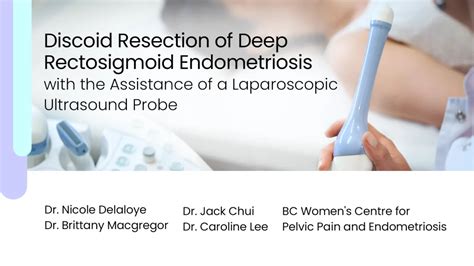 Discoid Resection Of Deep Rectosigmoid Endometriosis With The Assistance Of A Laparoscopic