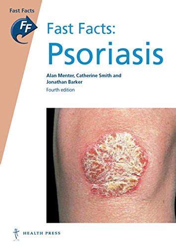 Fast Facts Psoriasis English Edition Ebook Menter Alan Smith Catherine Barker Jonathan