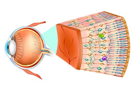 Retina Conditions Melbourne Retina Disease Treatment Titusville