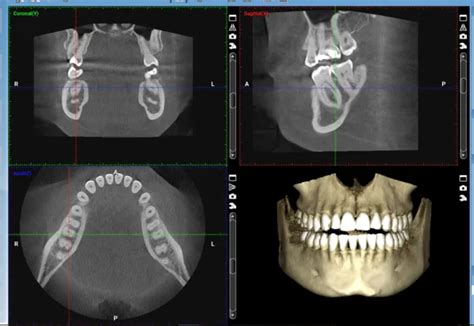 Cbct Technology General Dentist In Pittsburgh Pa The Dentists At Mercy