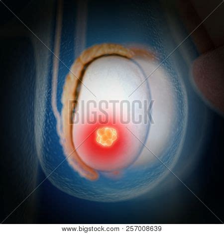 Testicles Images Illustrations Vectors Free Bigstock