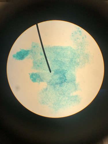 Algae Spp Flashcards Quizlet