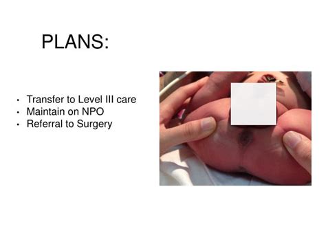 Ppt Imperforate Anus Powerpoint Presentation Id 6919535
