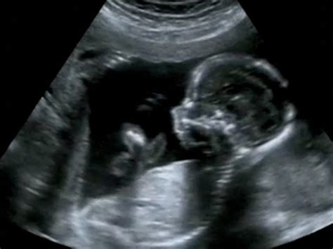 The Stages Of Fetal Development Human Life International