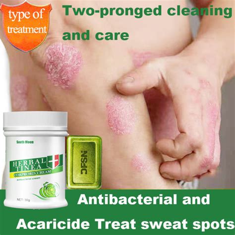 【removal Of Ringworm And Sweat Spot Set】 Anti Mite Anti Bacterial And