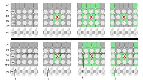 Hyperacusis — Hearing Health Foundation