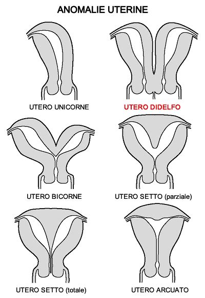 Utero Didelfo Cause E Sintomi