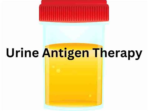 My Theory On Allergies Urine Antigen Therapy