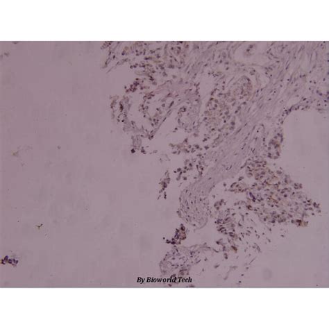 Anti Stat3 Phospho Y705 Antibody A27459