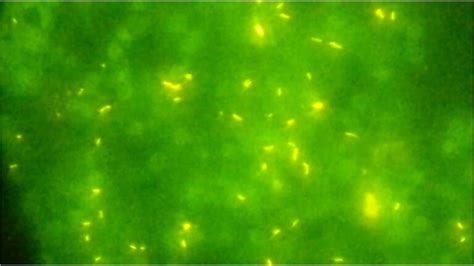 Mycobacterium Tuberculosis Introduction Morphology Pathogen