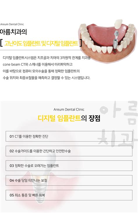 임플란트 아름치과의원