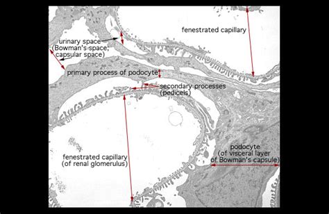 Glomerular Capsule Histology Labeled