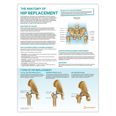 Replacement Parts Anatomystuff