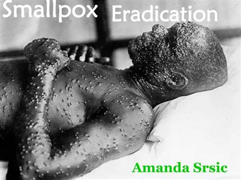 Ppt Smallpox Powerpoint Presentation Free Download Id3061148