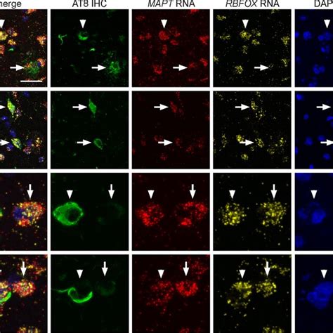 Fluorescent Rnascope Combined With Phosphorylated Tau At8