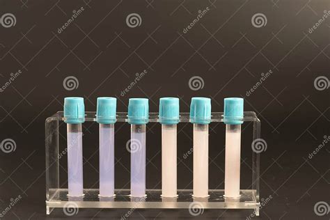 Test Tubes With Chemical Samples Stock Image Image Of Liquid