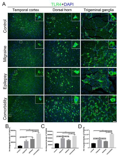 Localization Of Tlr4 In The Temporal Cortex Medullary Dorsal Horn And Download Scientific