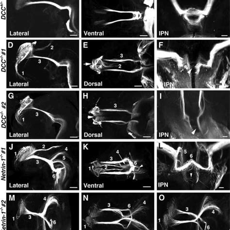 Fr Axon Guidance Defects In Slit And Robo Knockouts Download