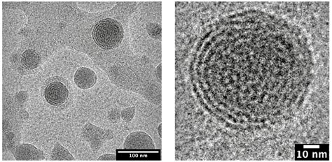 Breaking Barriers In Drug Delivery With Better Lipid Nanoparticles Biosciences Area