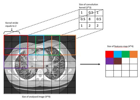 Deep Learning Convolutional Neural Networks For Medical Image Classification