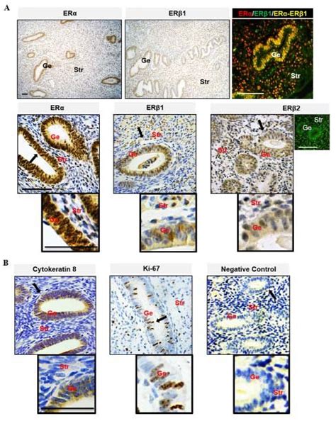 Localization Of Er Subtypes In The Human Endometria A The