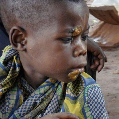 معرفی انواه بیماری های معده علائم و نشانه ها وی سلامت