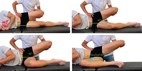 Iliotibial Band Syndrome Causes Symptoms Diagnosis Treatment
