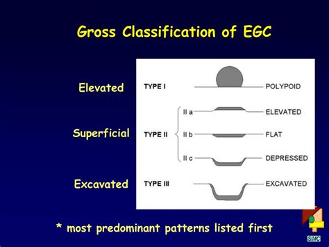Ppt 성균관의대 삼성서울병원 영상의학과 최동일 Powerpoint Presentation Id3429236