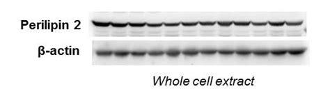 Perilipin 2 Adfp Antibody Bsa Free Nb110 40877 Novus Biologicals