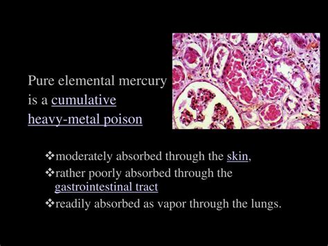 PPT Toxic Effects Of Mercury Hg PowerPoint Presentation Free Download ID