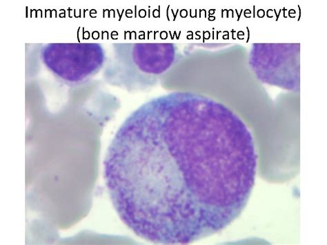 Hematology Laboratory 1 2414 Examination Of The Peripheral