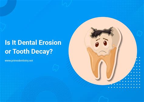 Is It Dental Erosion Or Tooth Decay Prime Dentistry