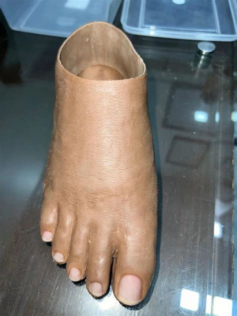 Silicone Foot Prosthesis At ₹ 65000 In New Delhi Id 22740802648
