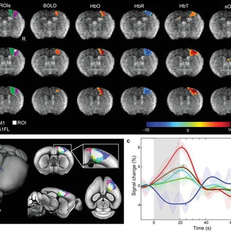 Group‐level Analysis Of Responses To The Sensory Stimulation A Download Scientific Diagram