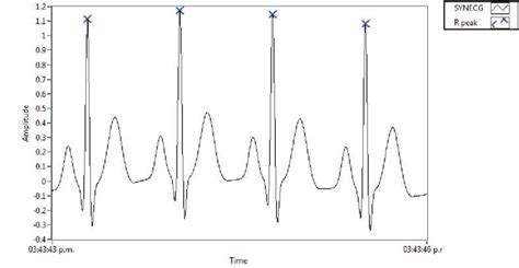 Detection Of R Peak With A Synthetized ECG Signal Download Scientific Diagram