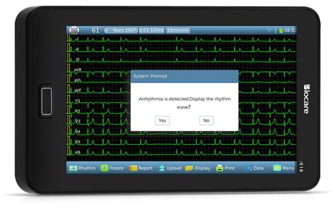 Point Of Care 12 Lead Ecgekg Machine Based On A Tablet With Auto Interpretation And Analysis