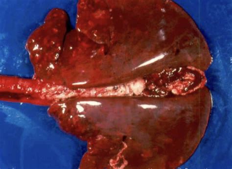 Congestion And Hyperaemia Identification Flashcards Quizlet