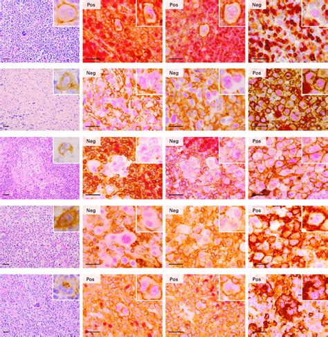 B2 Microglobulin B2m Major Histocompatibility Complex Mhc Class I